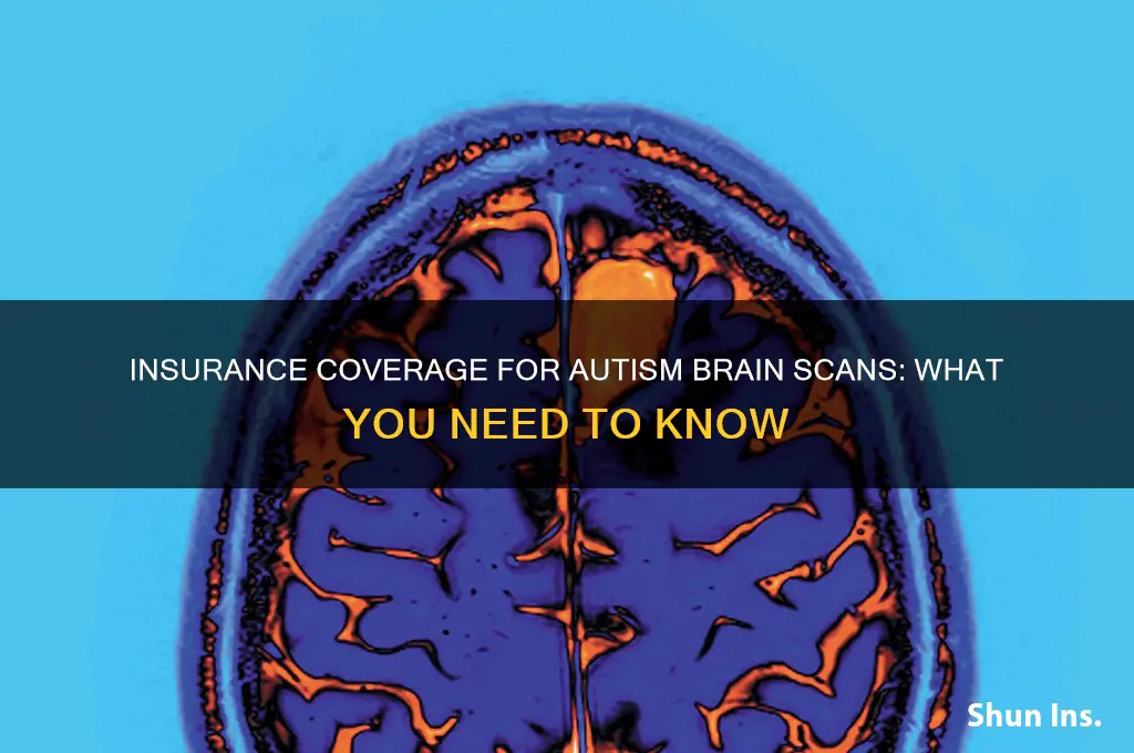 Insurance Coverage For Autism Brain Scans: What You Need To Know | ShunIns