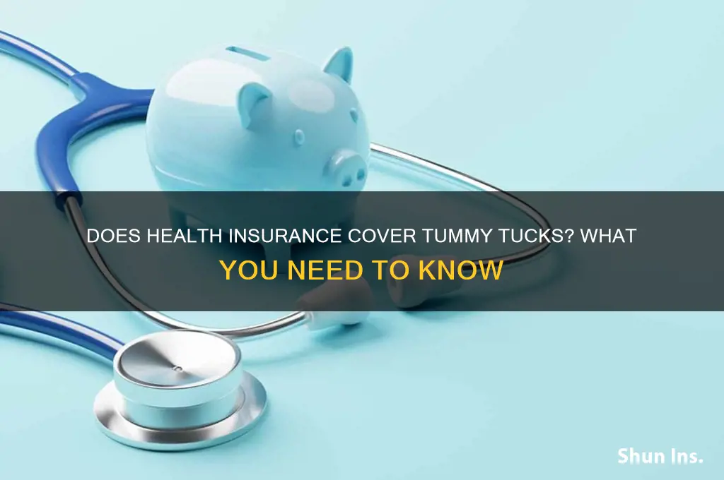 Does Health Insurance Cover Tummy Tucks? What You Need To Know | ShunIns