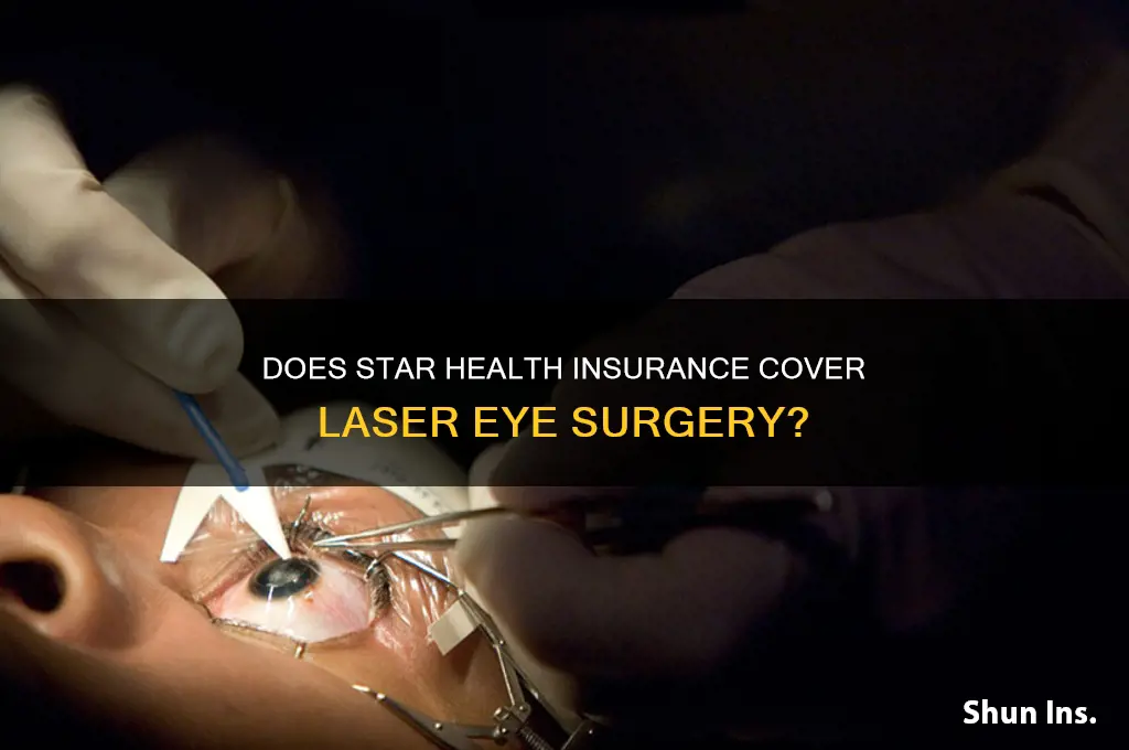 Does Star Health Insurance Cover Laser Eye Surgery? | ShunIns
