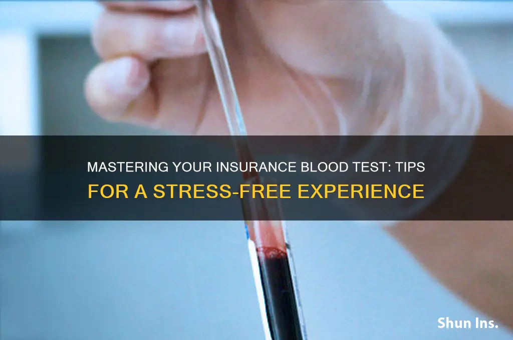 Mastering Your Insurance Blood Test: Tips For A Stress-Free Experience ...