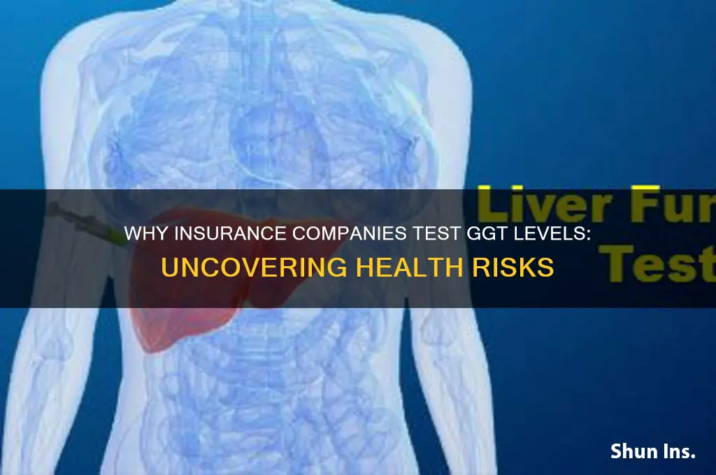 Why Insurance Companies Test Ggt Levels: Uncovering Health Risks | ShunIns